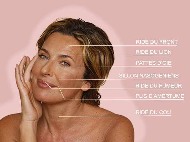 Les rides du visage - Solutions pour rajeunir sans chirurgie