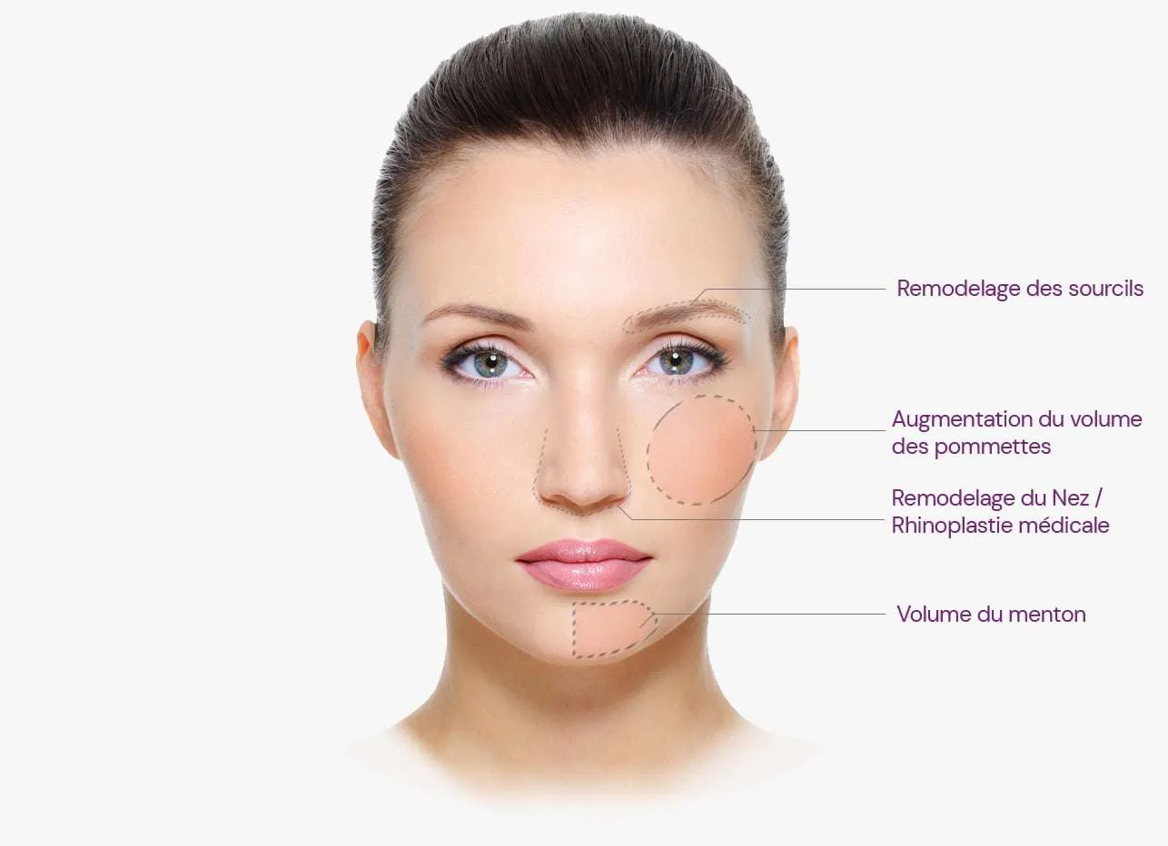 Injection acide hyaluronique - Pour une peau plus lisse et hydratée